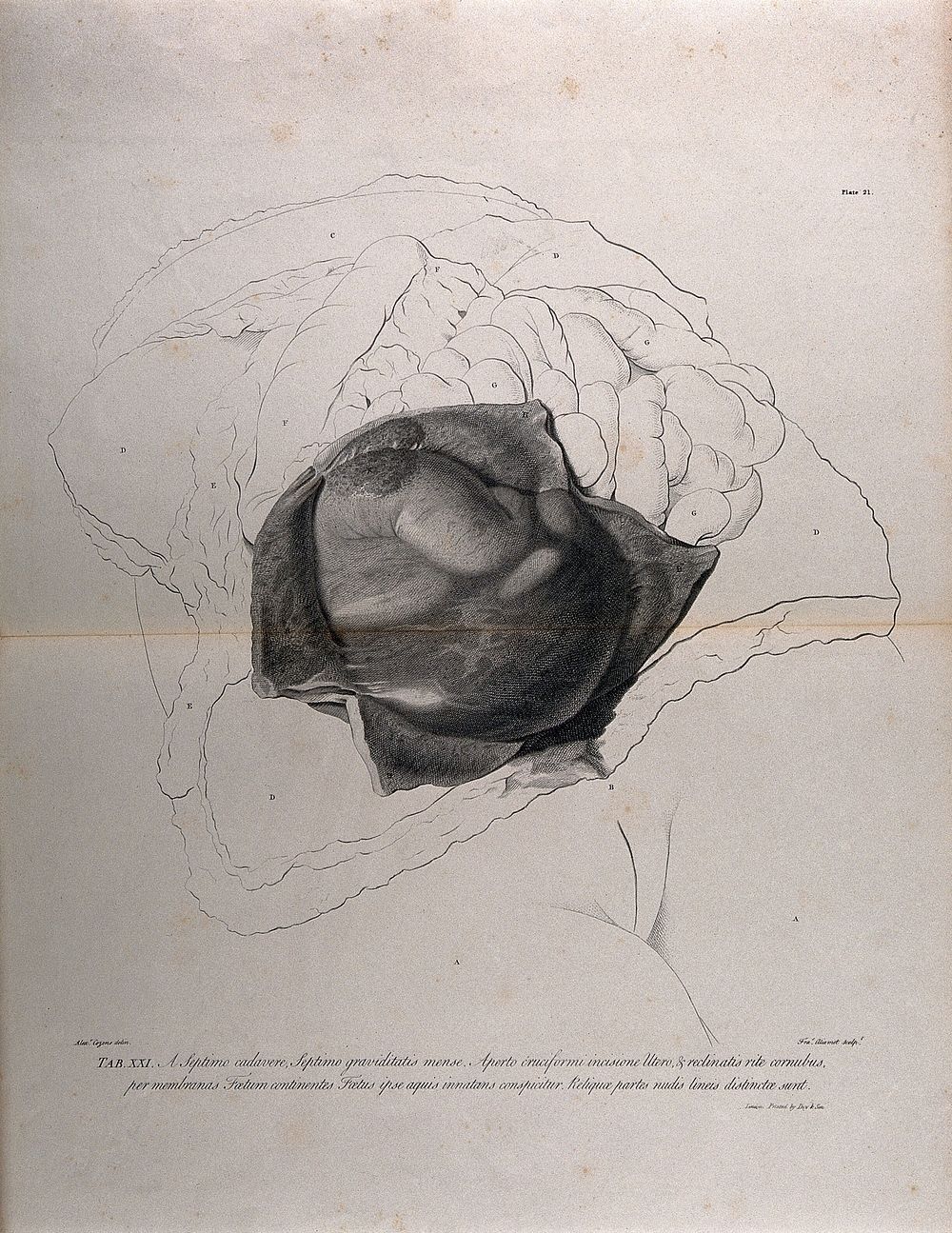Dissection female abdomen, showing part | Free Photo Illustration ...