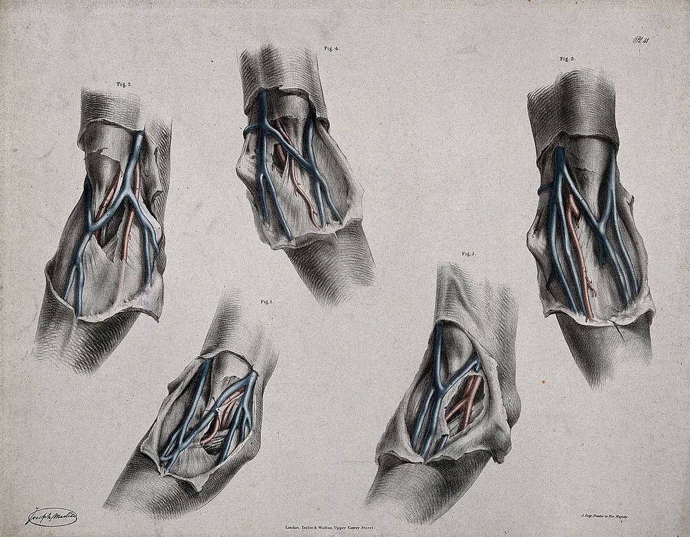 circulatory system: dissections elbow, arteries | Free Photo ...