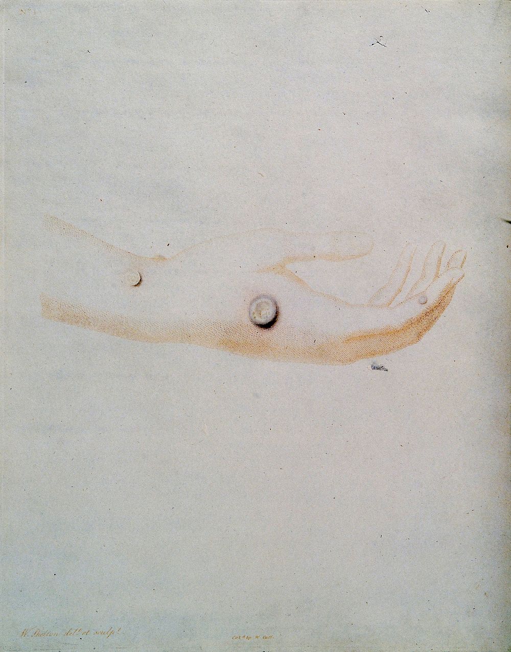 hand Sarah Nelmes three cowpox | Free Photo Illustration - rawpixel