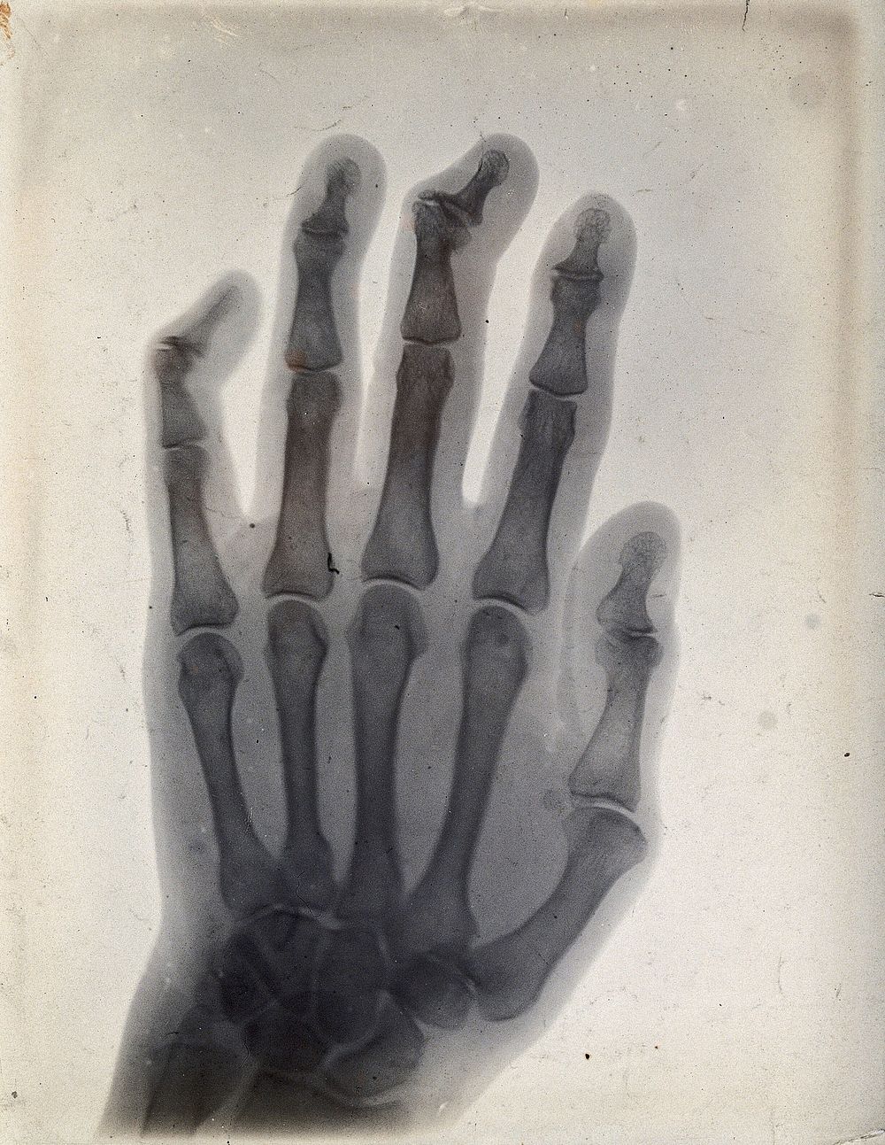 bones hand, viewed x-ray. Photoprint | Free Photo - rawpixel