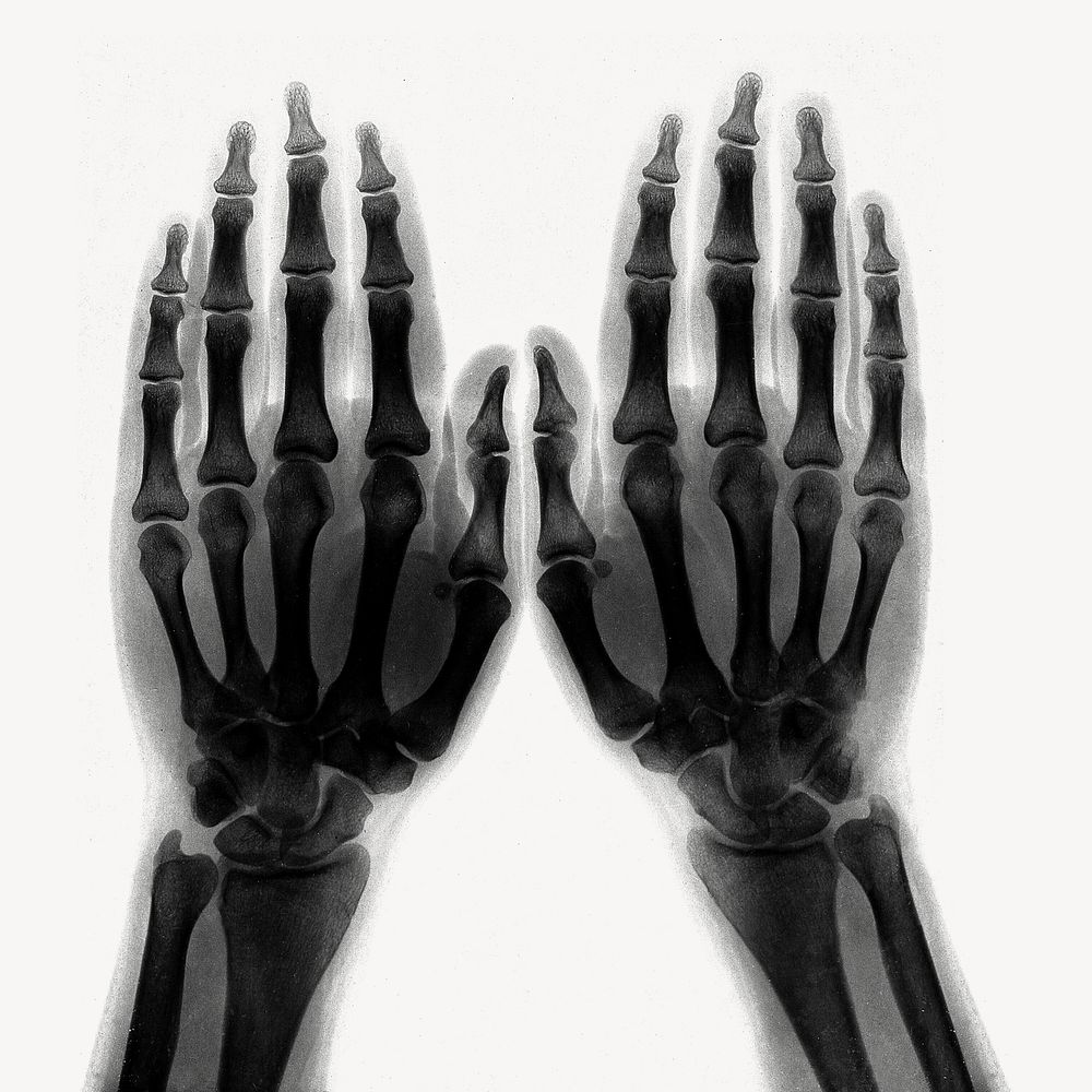 Vintage human x-ray hands illustration | Free Photo - rawpixel