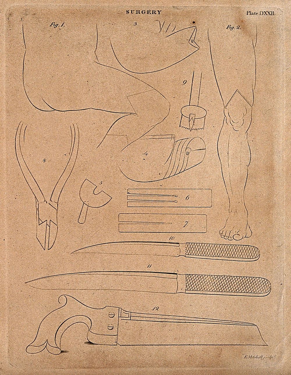 Surgical instruments treatment leg injuries | Free Photo Illustration ...