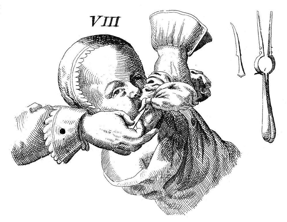 J. Scultetus "Armamentarium...", 1655, figure | Free Photo Illustration ...